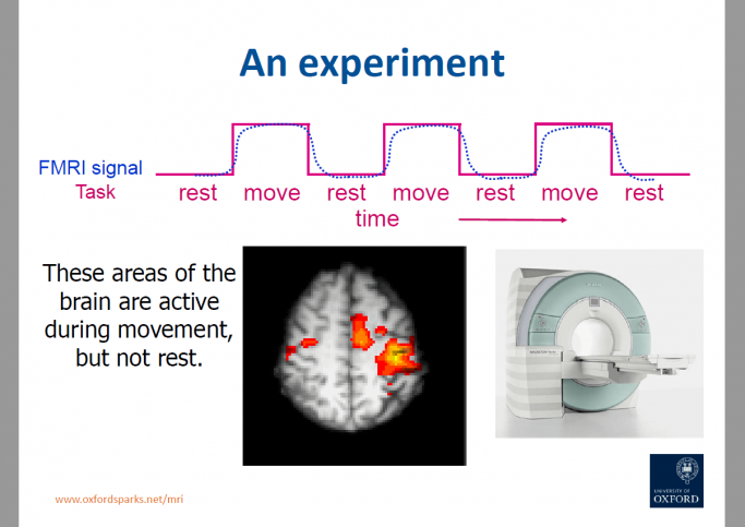 KS4 Science Lesson – Watching the Brain at Work | Teachwire Teaching ...