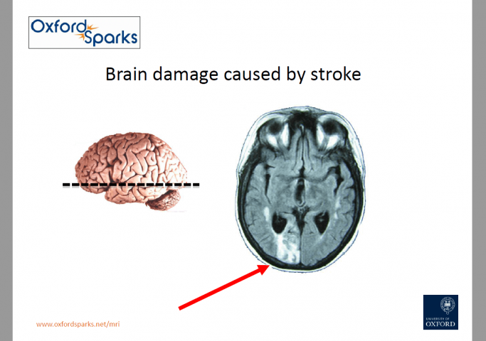 KS3 Science Lesson – MRI Brain Briefing | Teachwire Teaching Resource