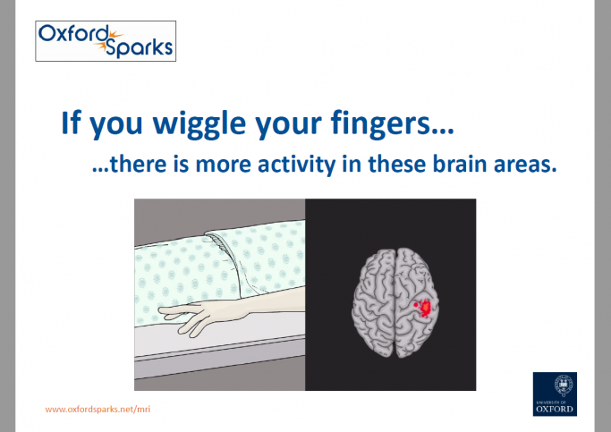 KS4 Science Lesson – Watching the Brain at Work | Teachwire Teaching ...